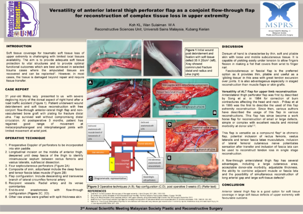 Versatility of anterior lateral thigh perforator flap as a conjoint ...