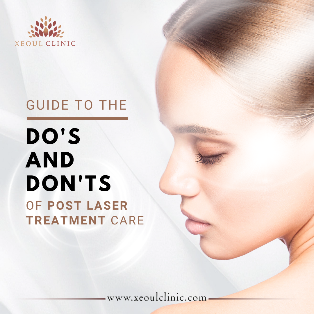 Do and Don’t after laser treatment - Xeoul Clinic